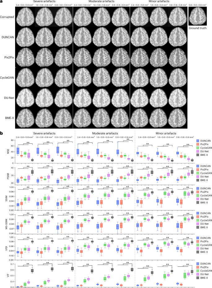 Nature BME | 用于增强磁共振图像和下游分割、配准和诊断任务的基础模型_澎湃号·湃客_澎湃新闻-The Paper