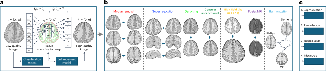Nature BME | 用于增强磁共振图像和下游分割、配准和诊断任务的基础模型_澎湃号·湃客_澎湃新闻-The Paper