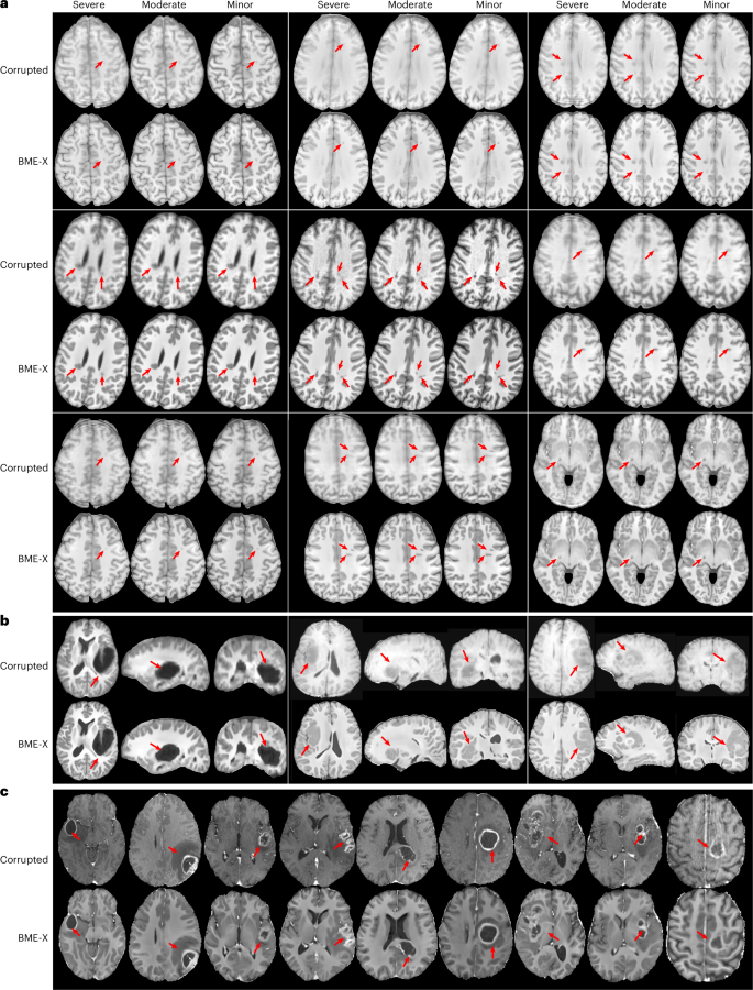 Nature BME | 用于增强磁共振图像和下游分割、配准和诊断任务的基础模型_澎湃号·湃客_澎湃新闻-The Paper